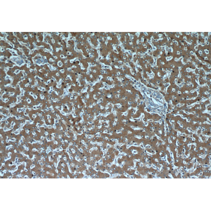 SLC25A25 Polyclonal Antibody（HZ51568） - 沪震生物官方商城 - 沪震生物-试剂盒,ELISA试剂盒 ...